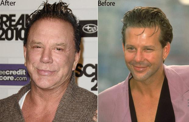 Mickey Rourke'un Estetikten Önce ve Sonra Olmak Üzere Gizemli Hayatı ...