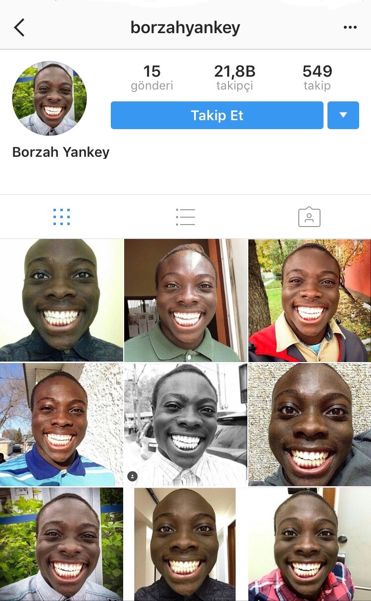 Instagram'da Sadece 32 Diş Sırıtarak Poz Veren Aşırı Mutlu ve Sevimli Fenomen Borzah Yankey ...