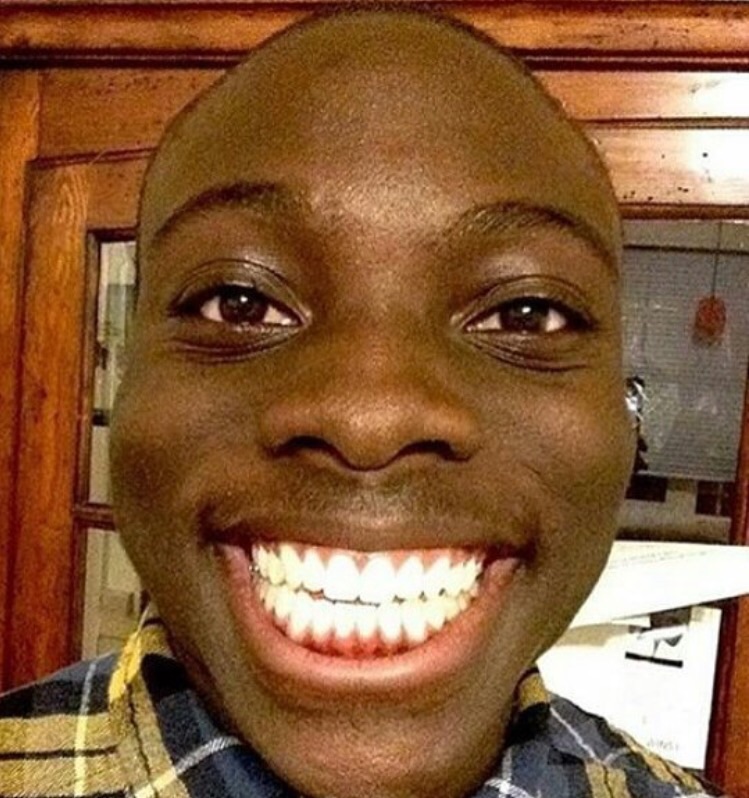 Instagram'da Sadece 32 Diş Sırıtarak Poz Veren Aşırı Mutlu ve Sevimli Fenomen Borzah Yankey ...