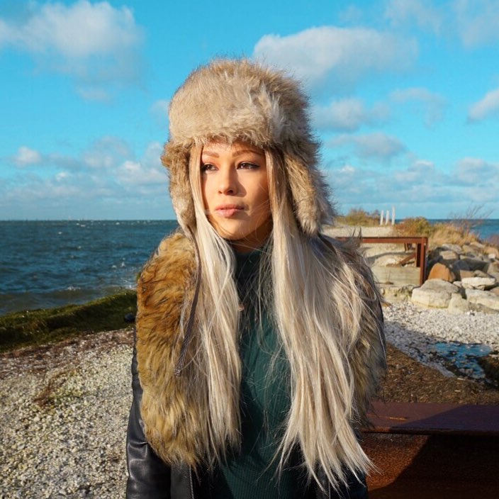 Saçkıran Hastalığıyla Barıştıktan Sonra Etkileyici Bir Modele Dönüşen ...