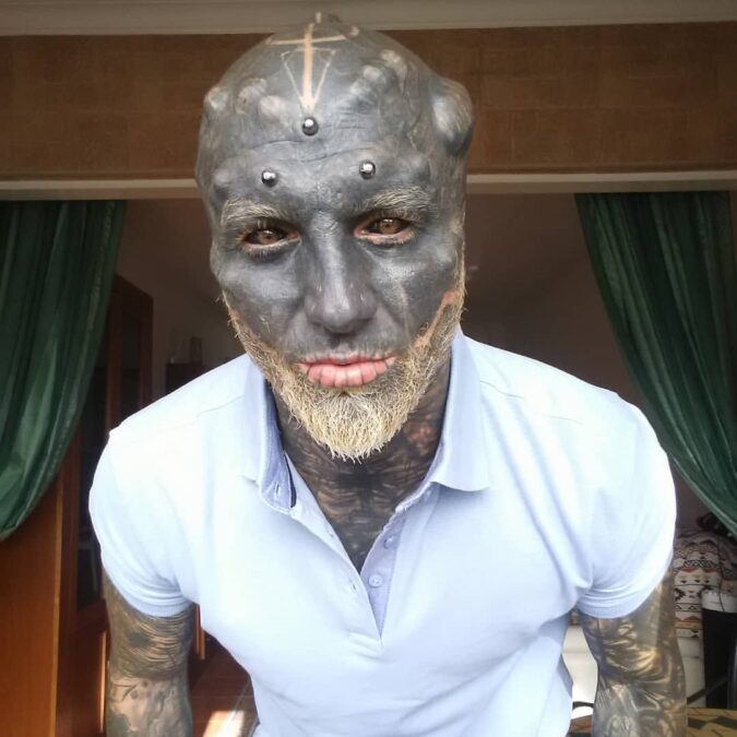 Uzaylı Gibi Görünmek İçin Burnunu Aldıran Anthony Loffredo