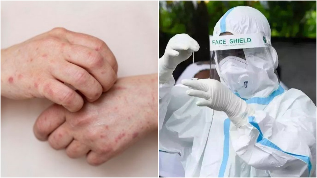 Hindistan'da Panik Yaratan Domates Gribi Nedir, Belirtileri Nelerdir?