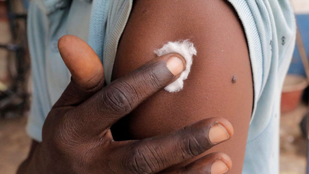 Maymun Çiçeği Virüsü Hakkında Bilmeniz Gereken 8 Şey