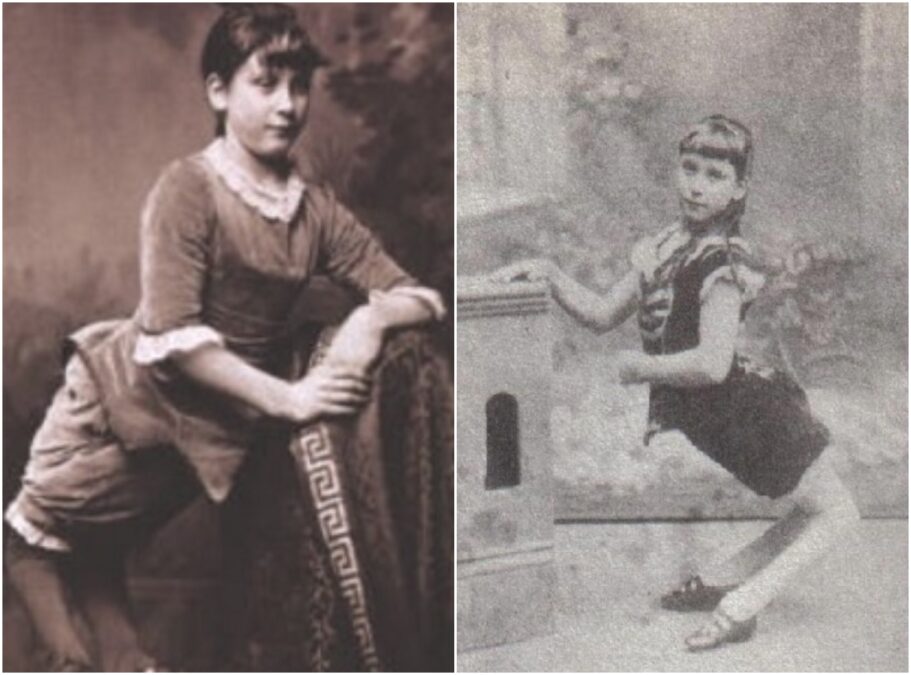 Deve Kız Olarak İsimlendirilen Ella Harper'ın Yürek Burkan Hikayesi