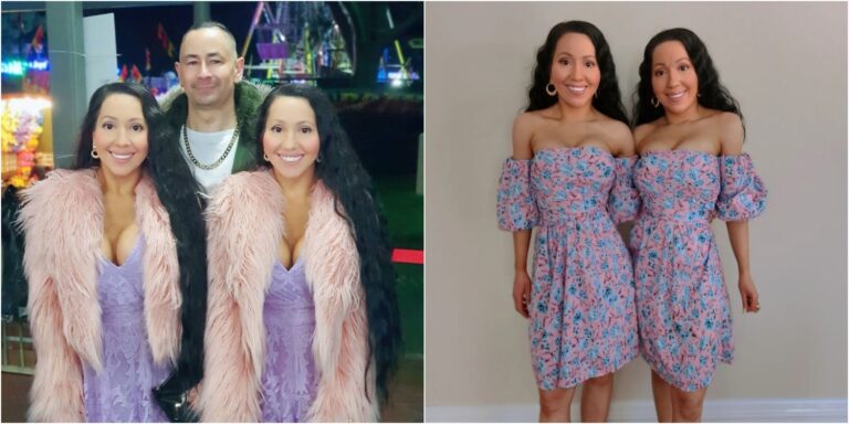 Anna ve Lucy DeCinque: Tek Bir Kişi Gibi Yaşayan İkiz Kardeşler