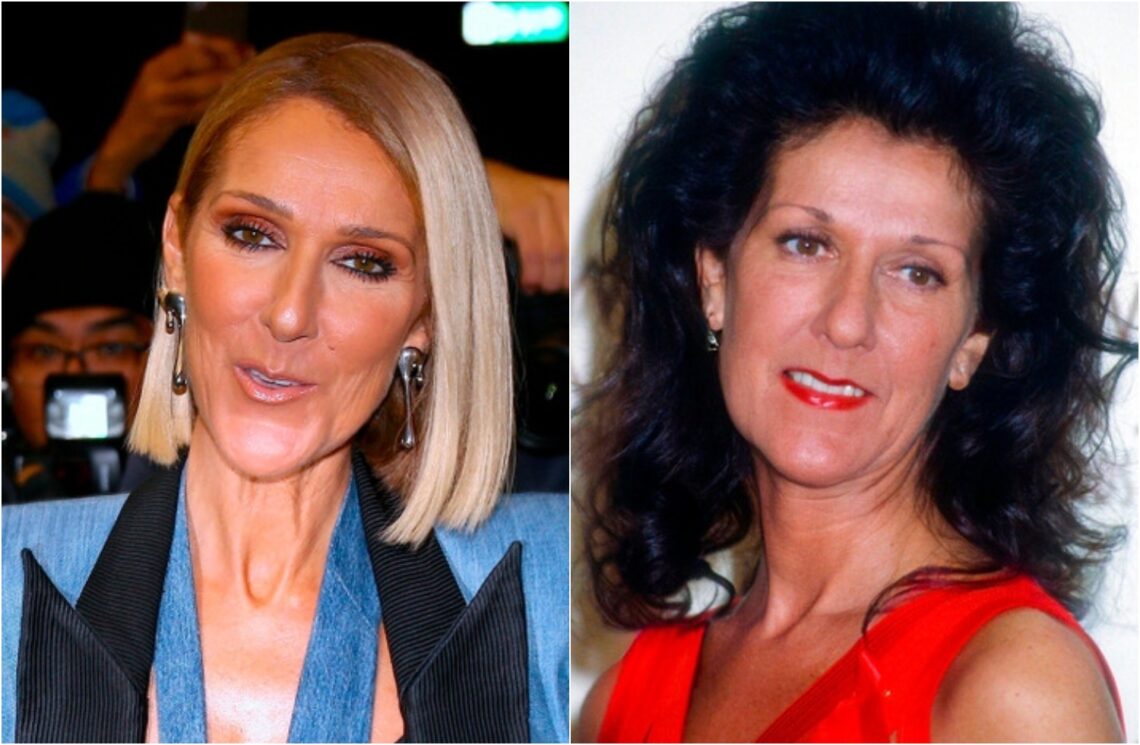 17 Ünlü İsim Estetik Ameliyat Olmasalardı Nasıl Görünürlerdi?