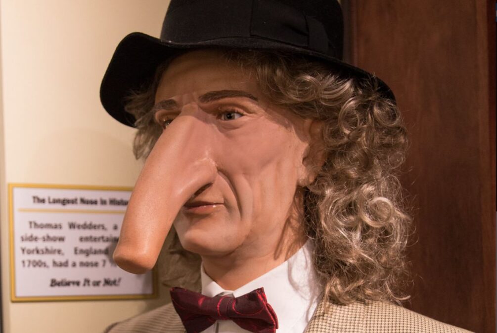 Tarihin En Uzun Burunlu İnsanı: Thomas Wadhouse
