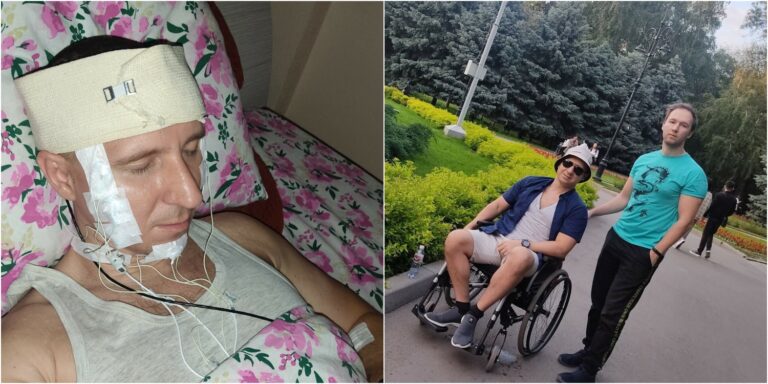 Michael Raduga: Rüyalarını Kontrol Edebilmek İçin Kafatasını Delen Adam