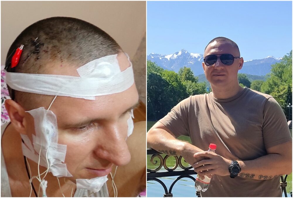 Michael Raduga: Rüyalarını Kontrol Edebilmek İçin Kafatasını Delen Adam