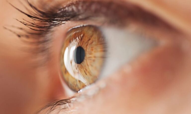 Ela Rengi Hakkında 10 Şaşırtıcı Gerçek | ListeList.com